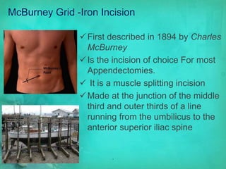 Abdominal surgery | PPTX