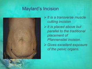 Abdominal surgery | PPT