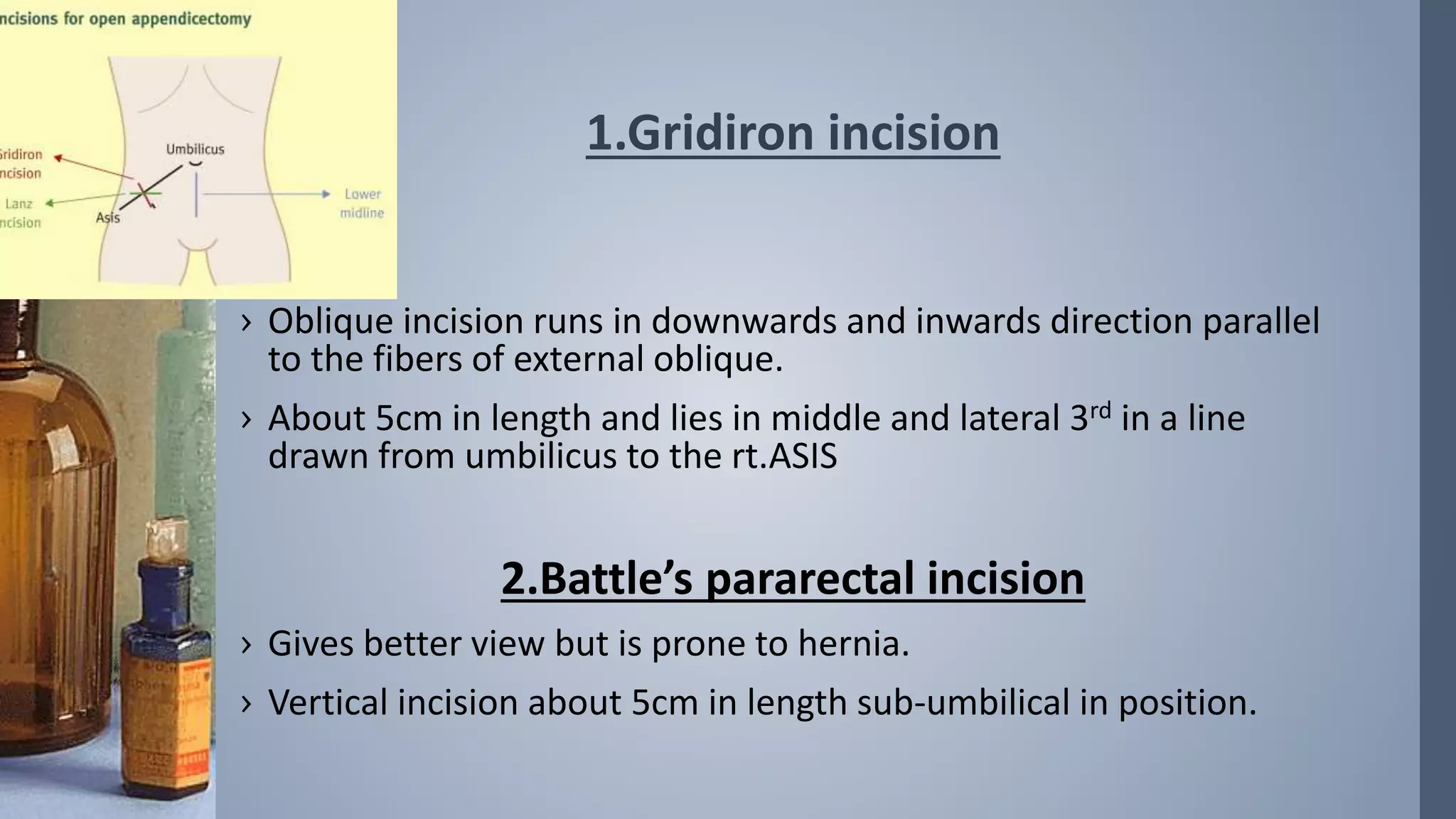 Abdominal surgery | PPTX