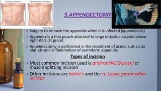 Abdominal surgery | PPTX