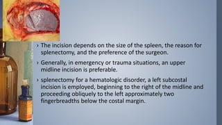 Abdominal surgery | PPTX