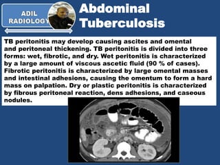 Abdominal tb | PPTX