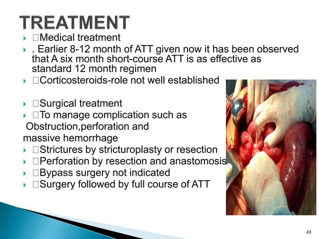 GASTROINTESTINAL TUBERCULOSIS ABDOMINAL TUBERCULOSIS | PPT