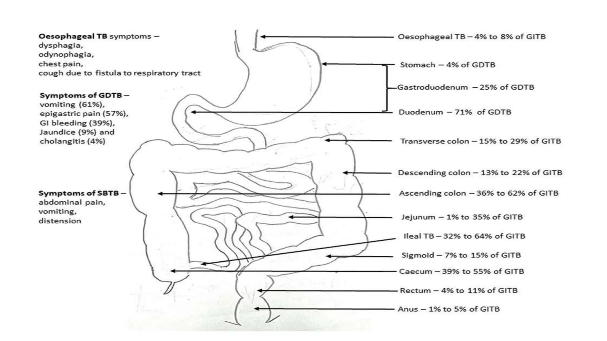 Abdominal Tuberculosis Evaluation and management pptx | PPTX