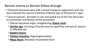 Abdominal Tuberculosis-Management | PPTX