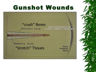 Abdominal trauma | PPT