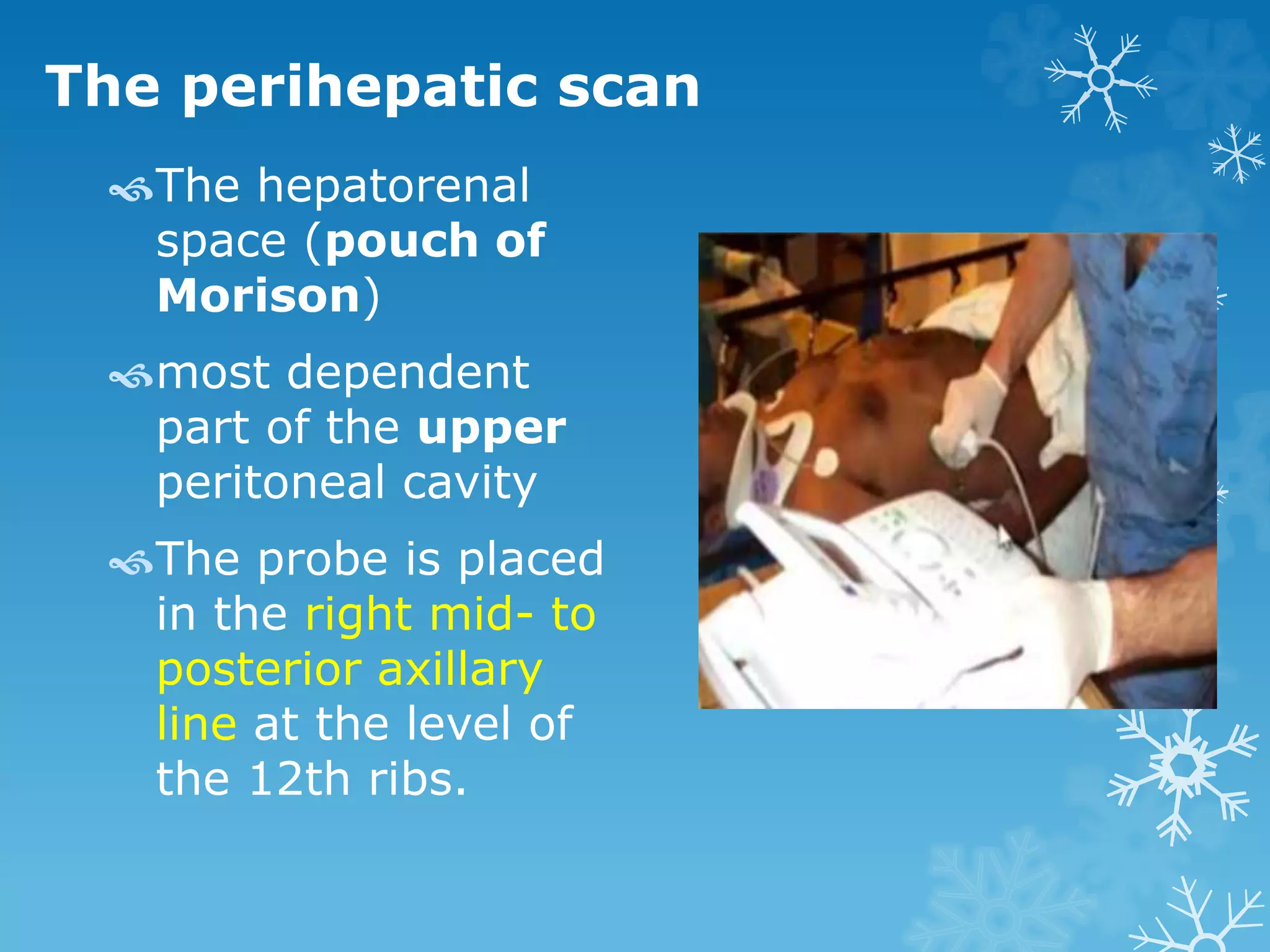 Abdominal trauma | PPTX