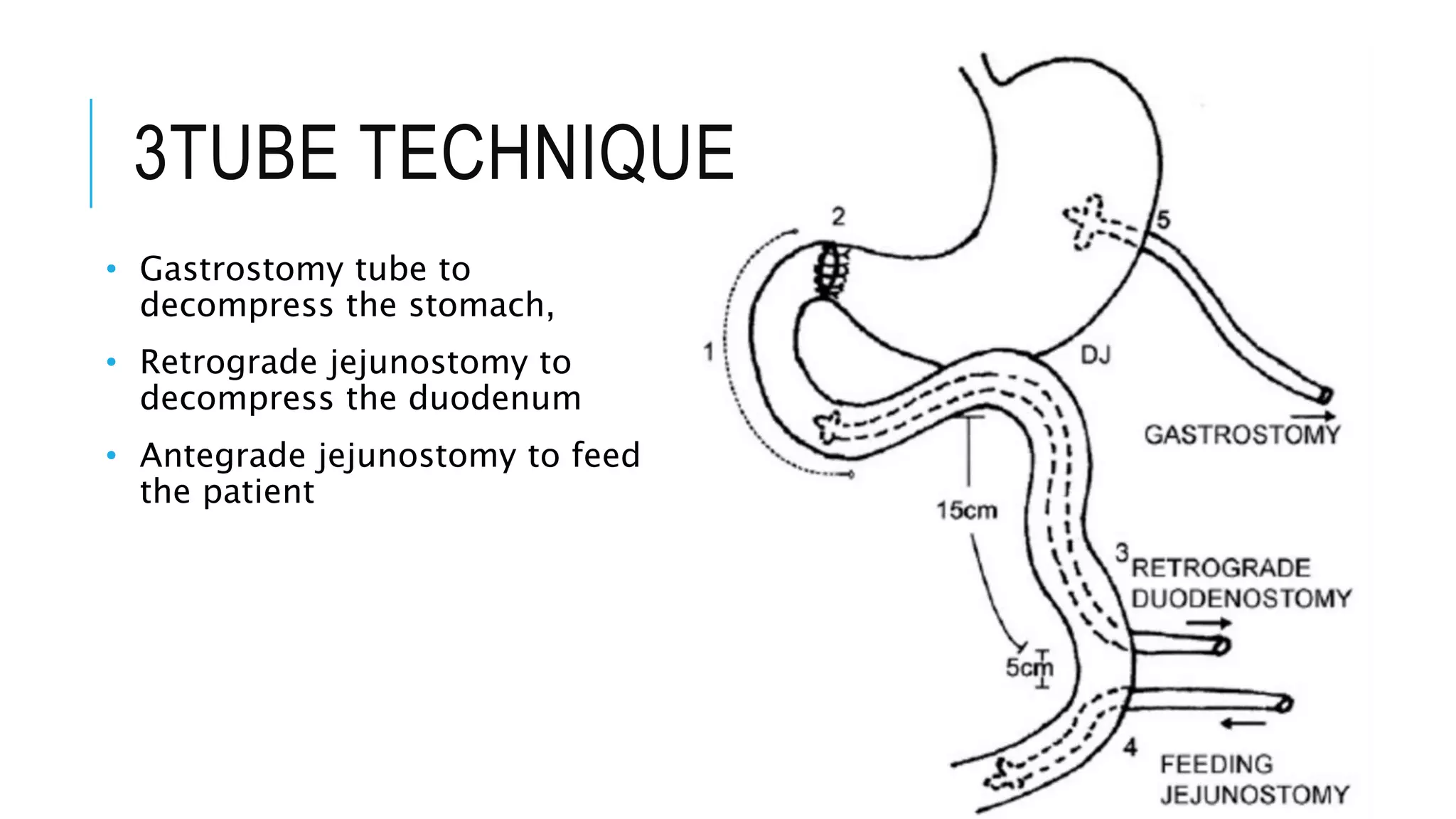 Abdominal trauma and Management | PPTX