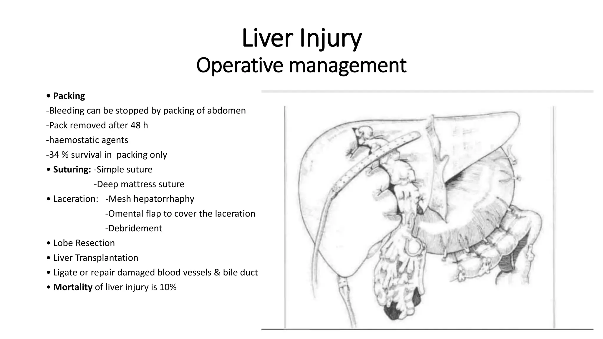 Abdominal trauma | PPTX