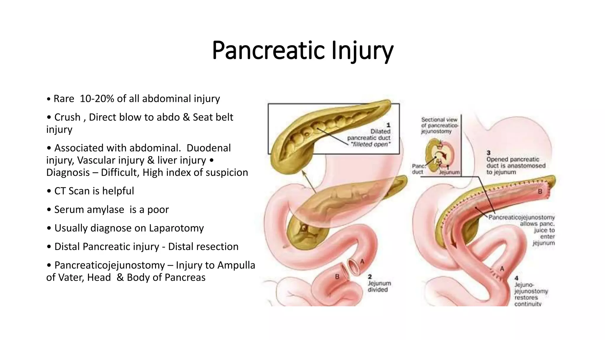 Abdominal trauma | PPTX