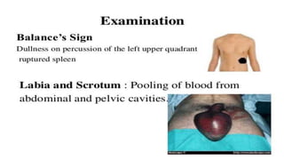 Abdominal trauma | PPTX