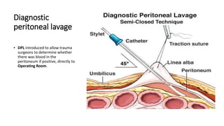 Abdominal trauma | PPTX