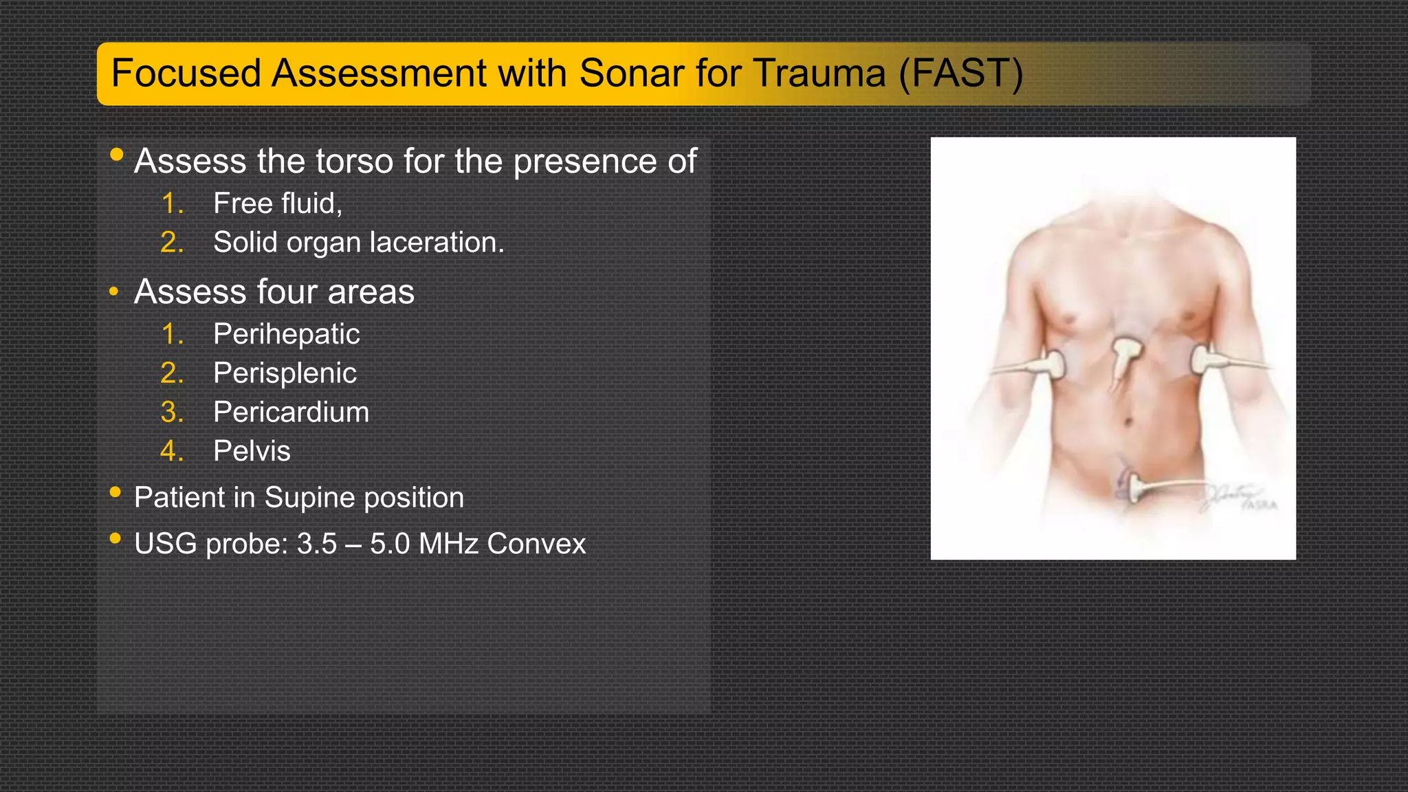 Abdominal trauma: diagnosis and management | PPTX