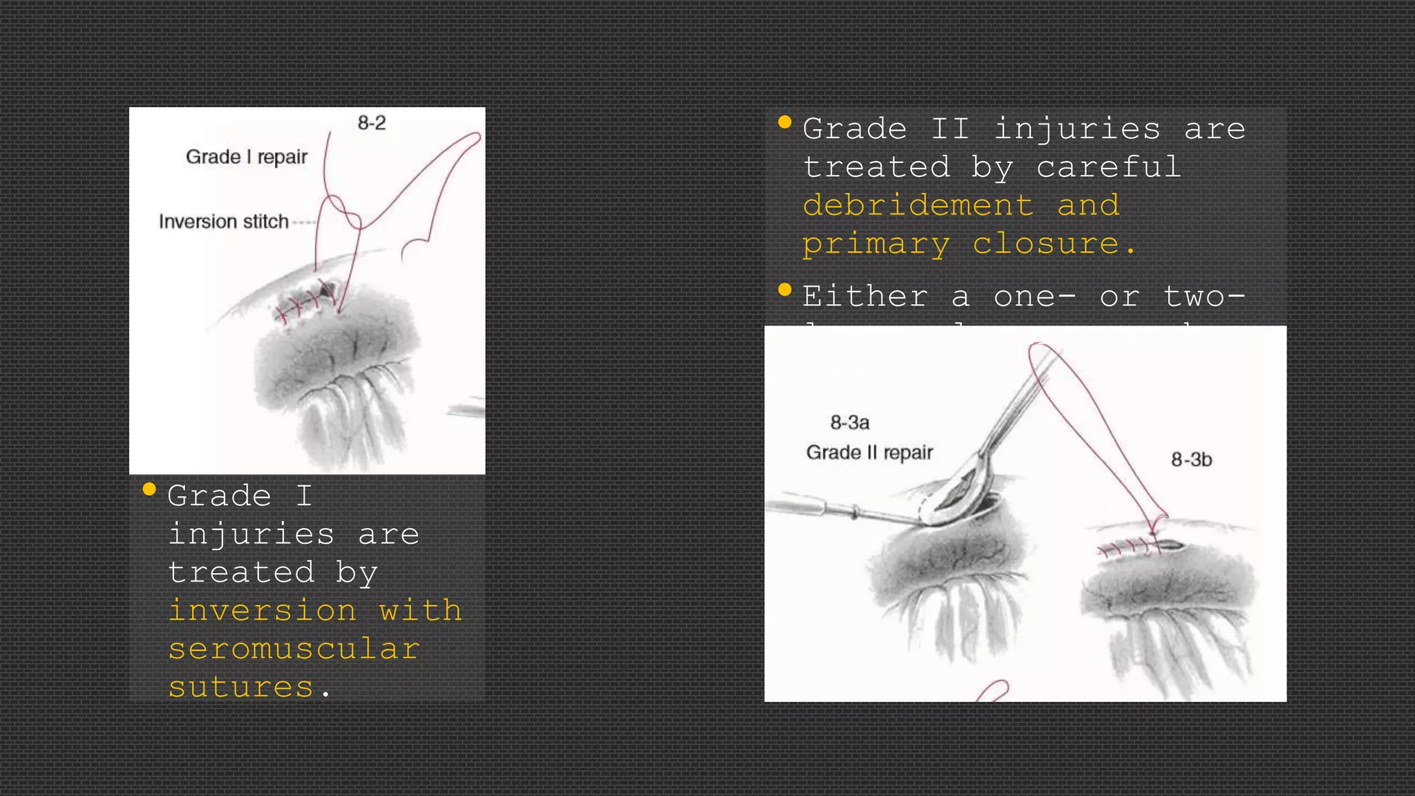 Abdominal trauma: diagnosis and management | PPTX