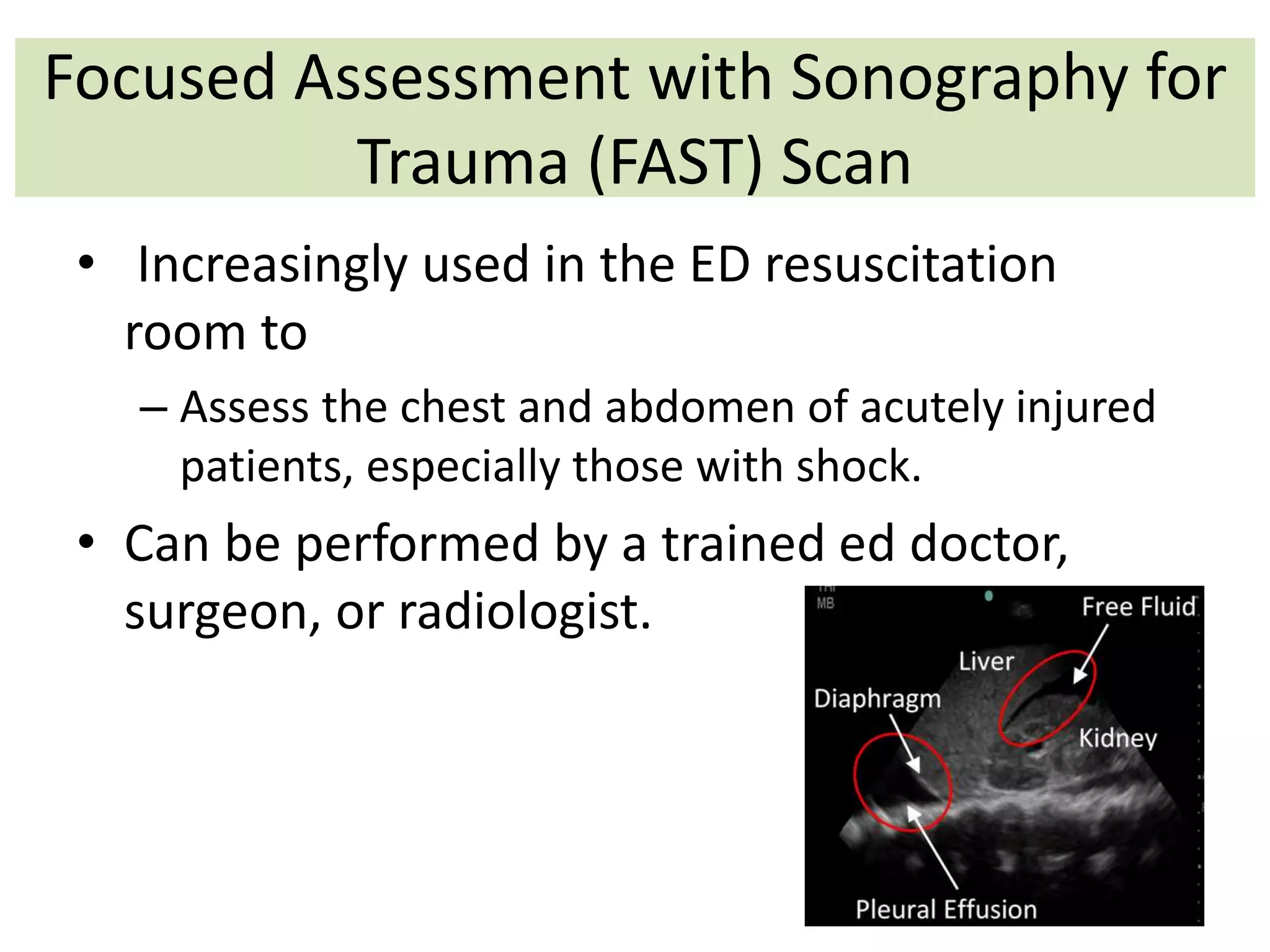 Abdominal trauma | PPTX