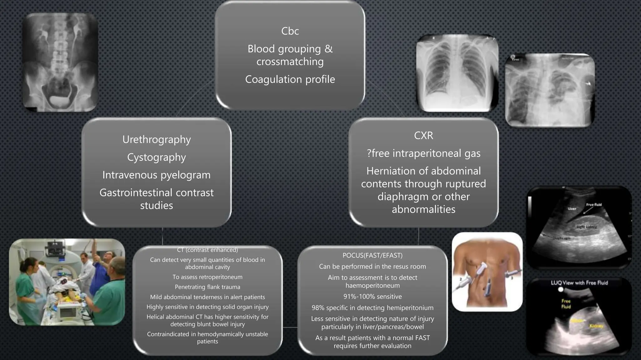 Abdominal trauma.pptx