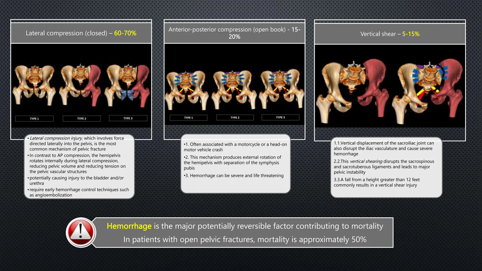 Abdominal trauma.pptx
