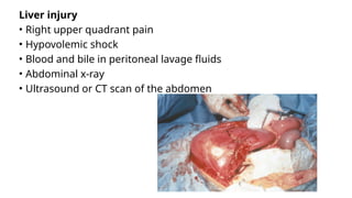 abdominal trauma powerpoint explained for medical students | PPTX