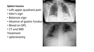 abdominal trauma powerpoint explained for medical students | PPT