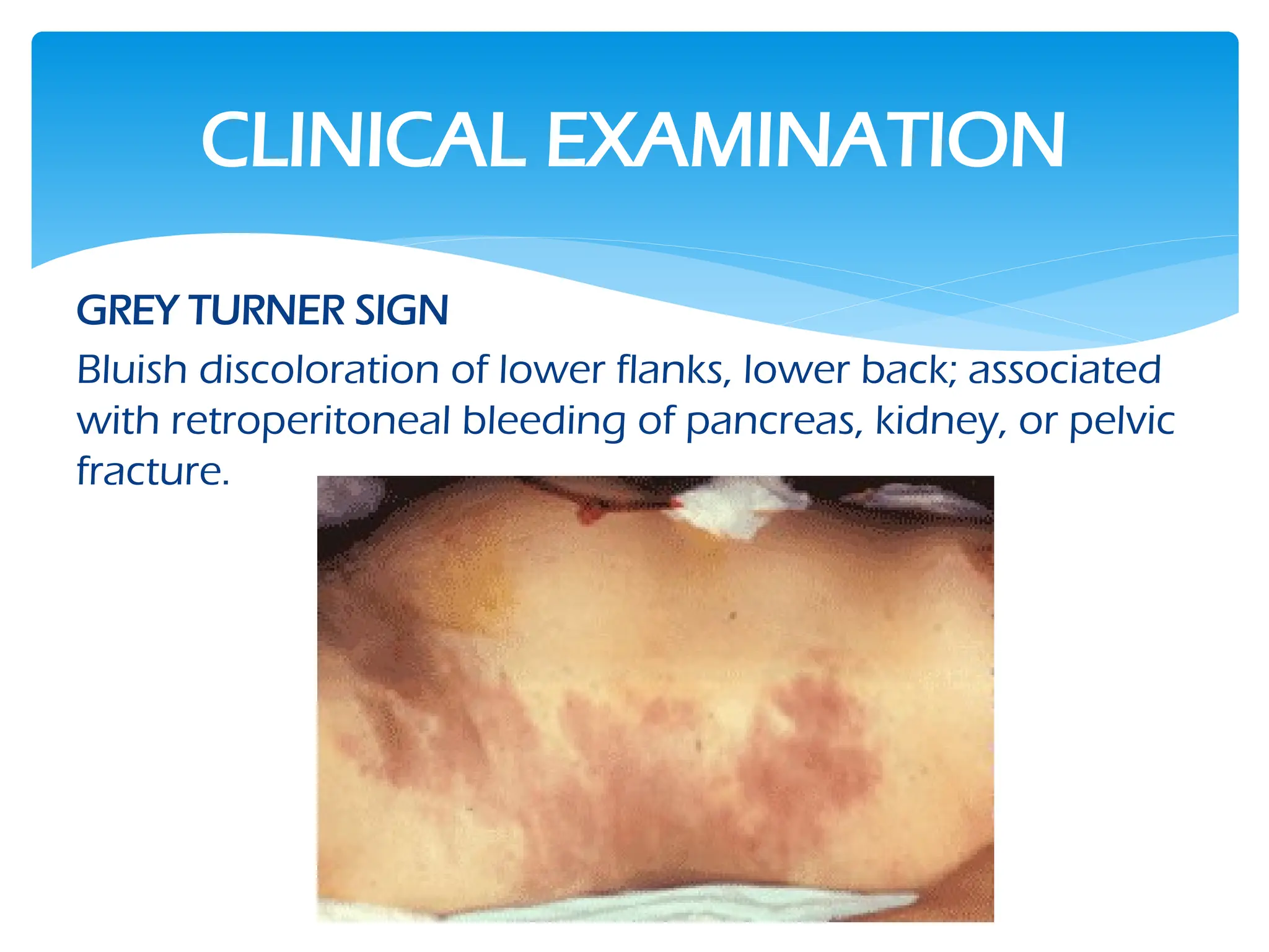 ABDOMINAL TRAUMA PRESENTATION, diagnosis | PPTX