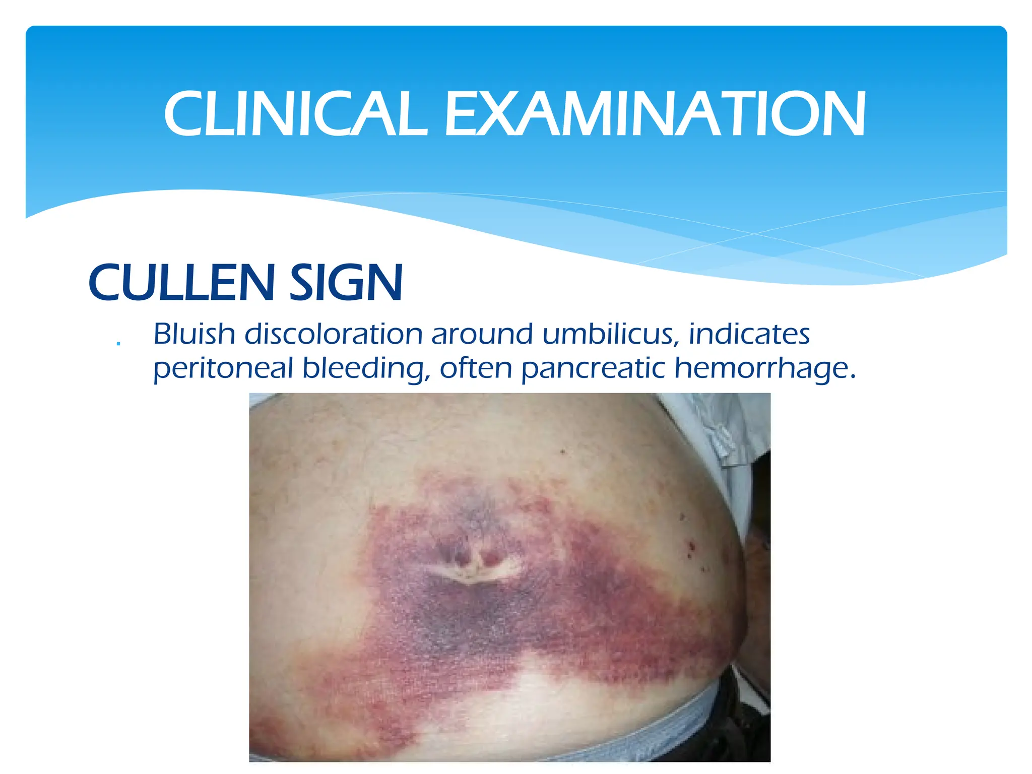 ABDOMINAL TRAUMA PRESENTATION, diagnosis | PPTX