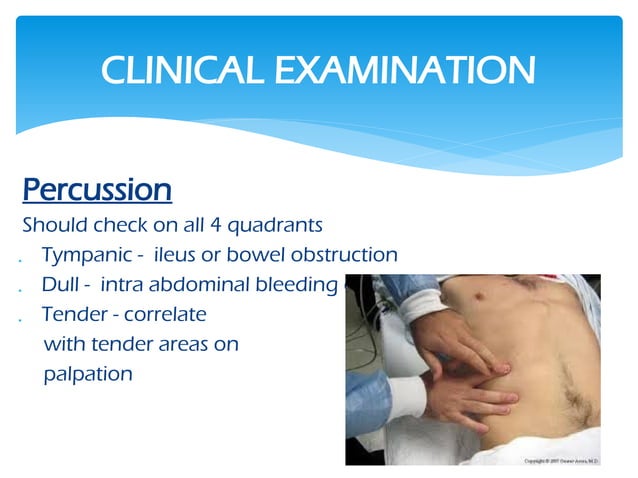 ABDOMINAL TRAUMA PRESENTATION, diagnosis | PPT
