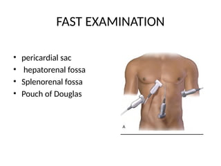 ABDOMINAL TRAUMA PPT Presentation .pptx