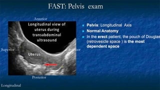Abdominal Trauma and FAST scan (Dr. Derhim Afaqeeh , Yemen ) | PPTX