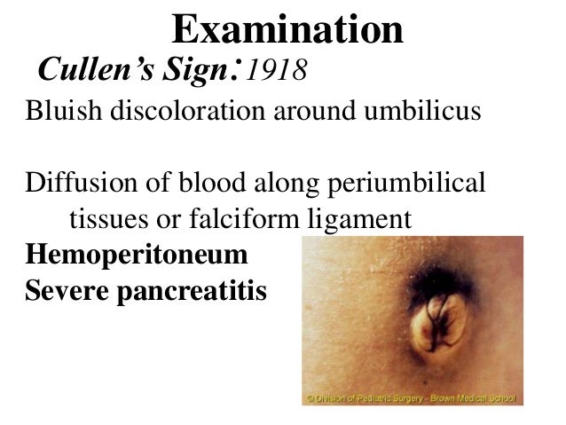 Abdominal trauma ,an overview