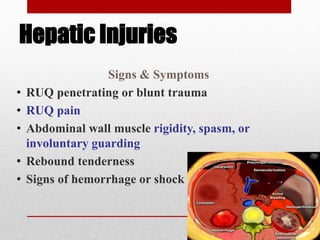 Abdominal Trauma for Nursing | PPTX