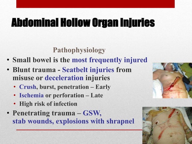 Abdominal Trauma for Nursing | PPTX