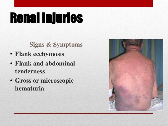 Abdominal Trauma for Nursing