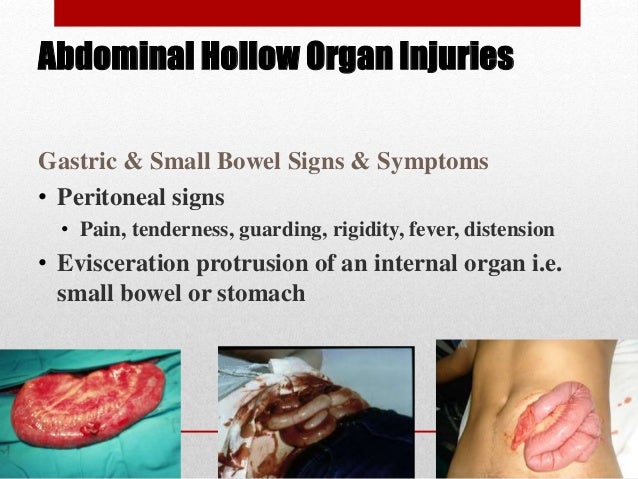 Abdominal Trauma for Nursing