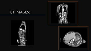 Abdominal Trauma Call Management Approach.pptx