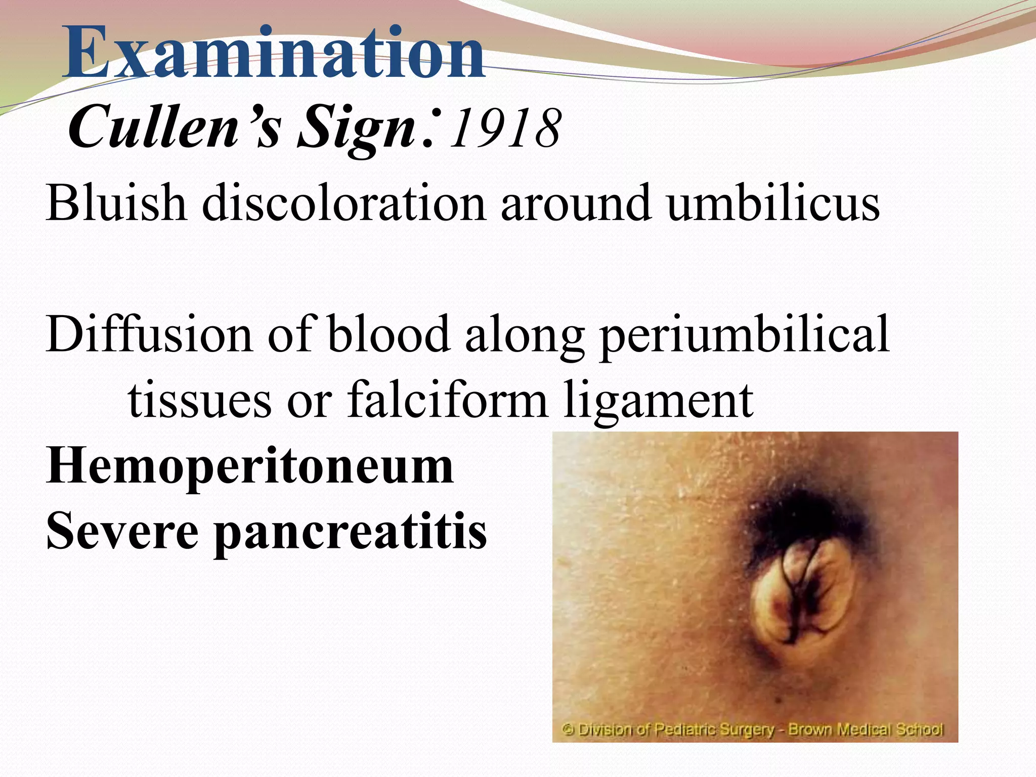 Abdominal trauma management | PPTX