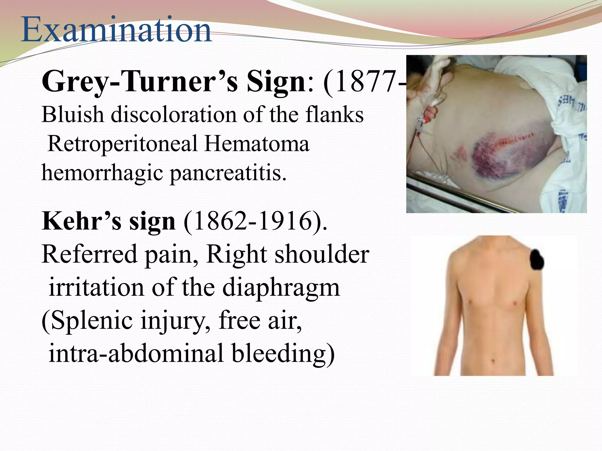 Abdominal trauma management | PPTX