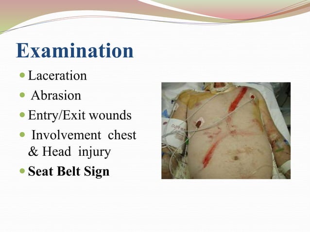 Abdominal trauma management | PPTX | First Aid | Injuries