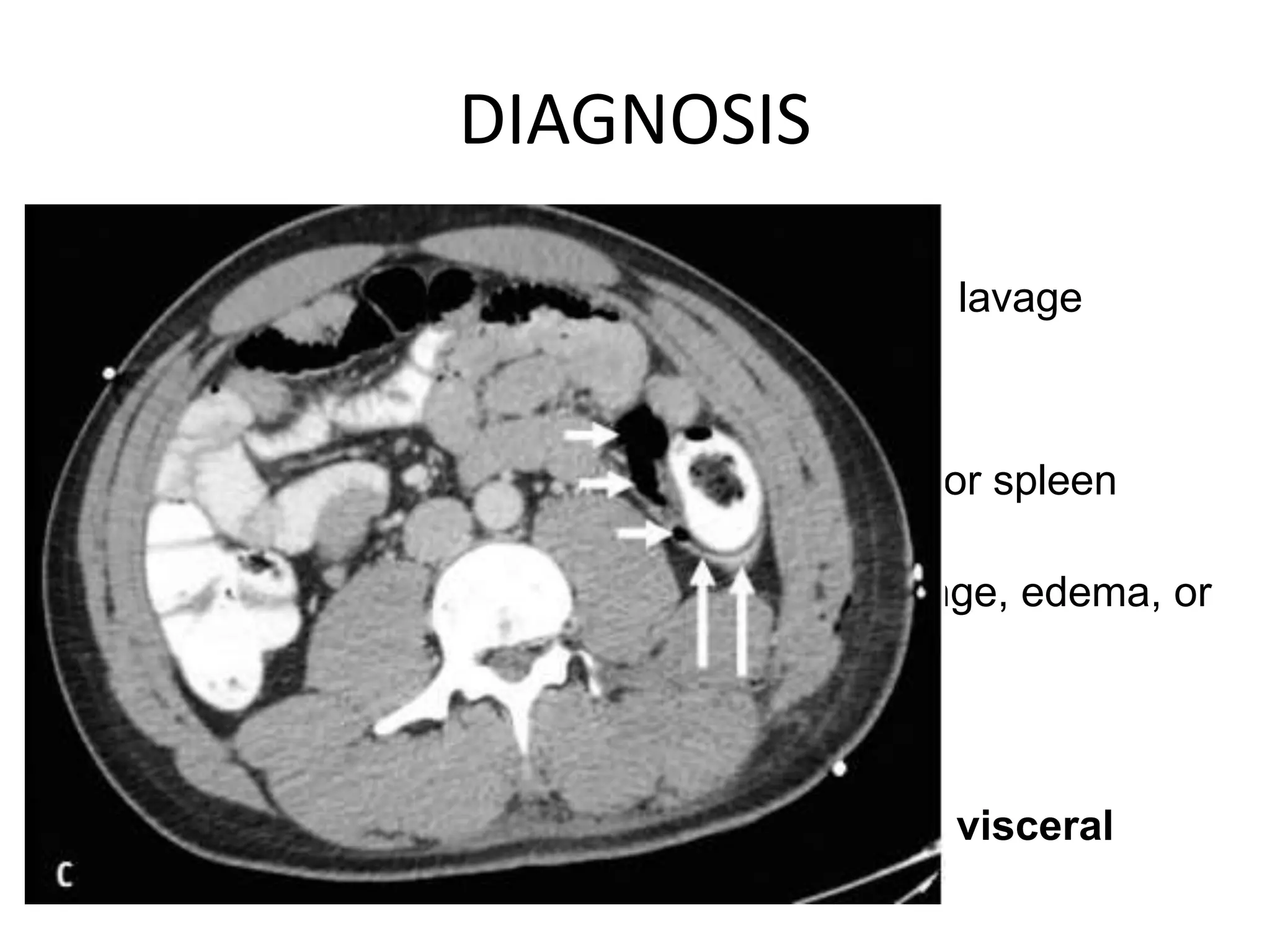 ABDOMINAL TRAUMA part 2bedrumohs, 2023.pptx