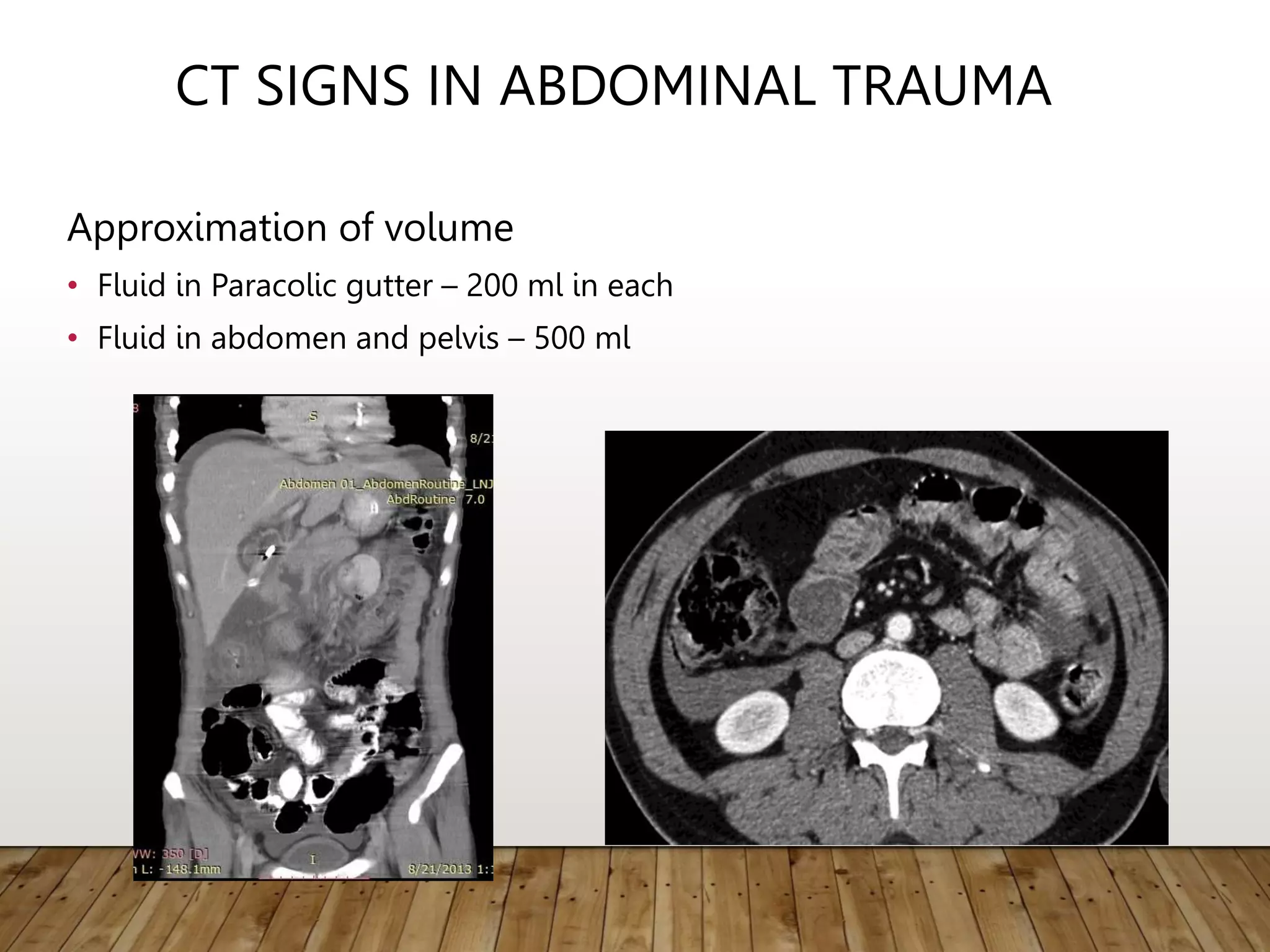 ABDOMINAL TRAUMA PPT.pptx