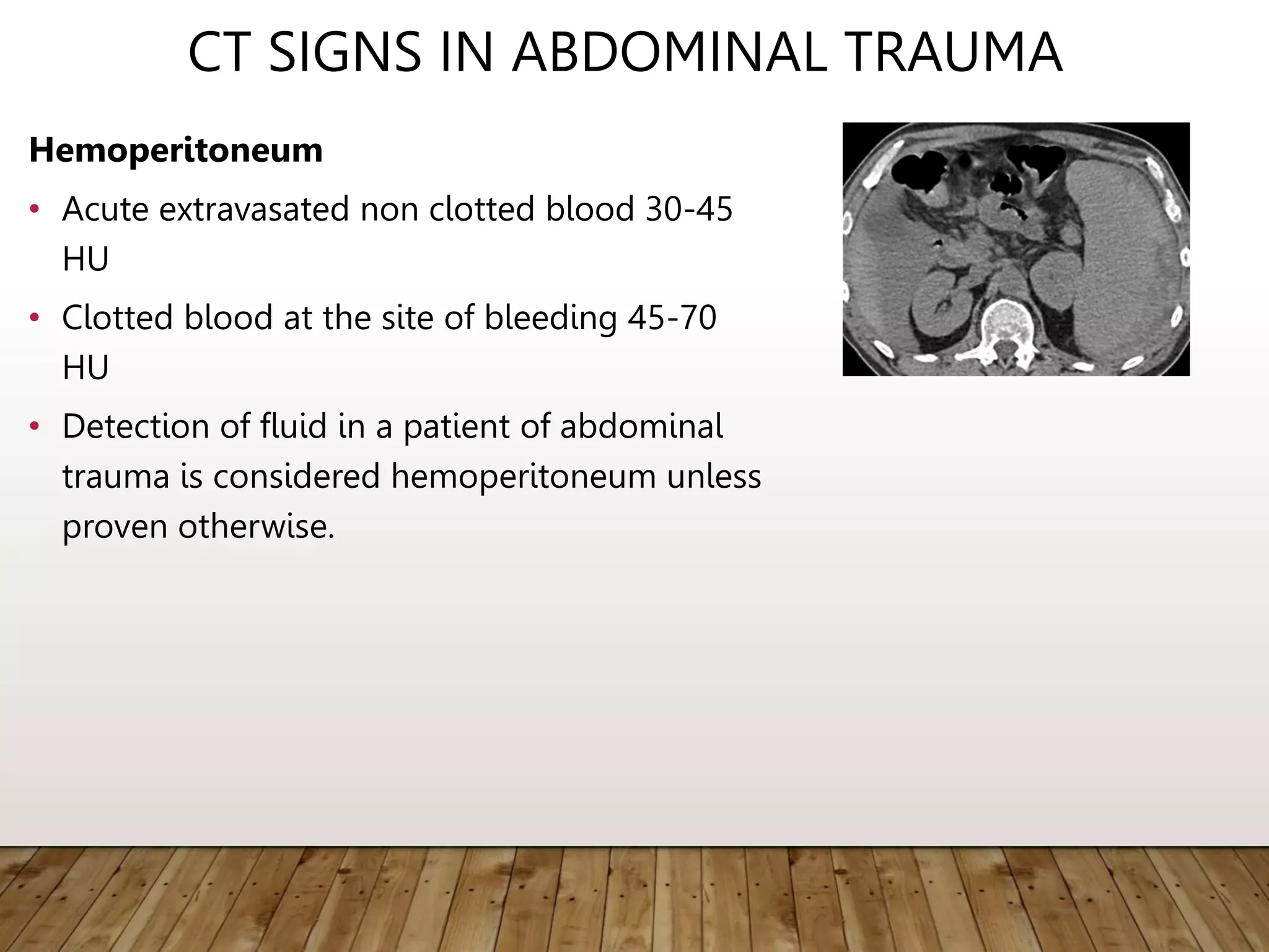 ABDOMINAL TRAUMA PPT.pptx