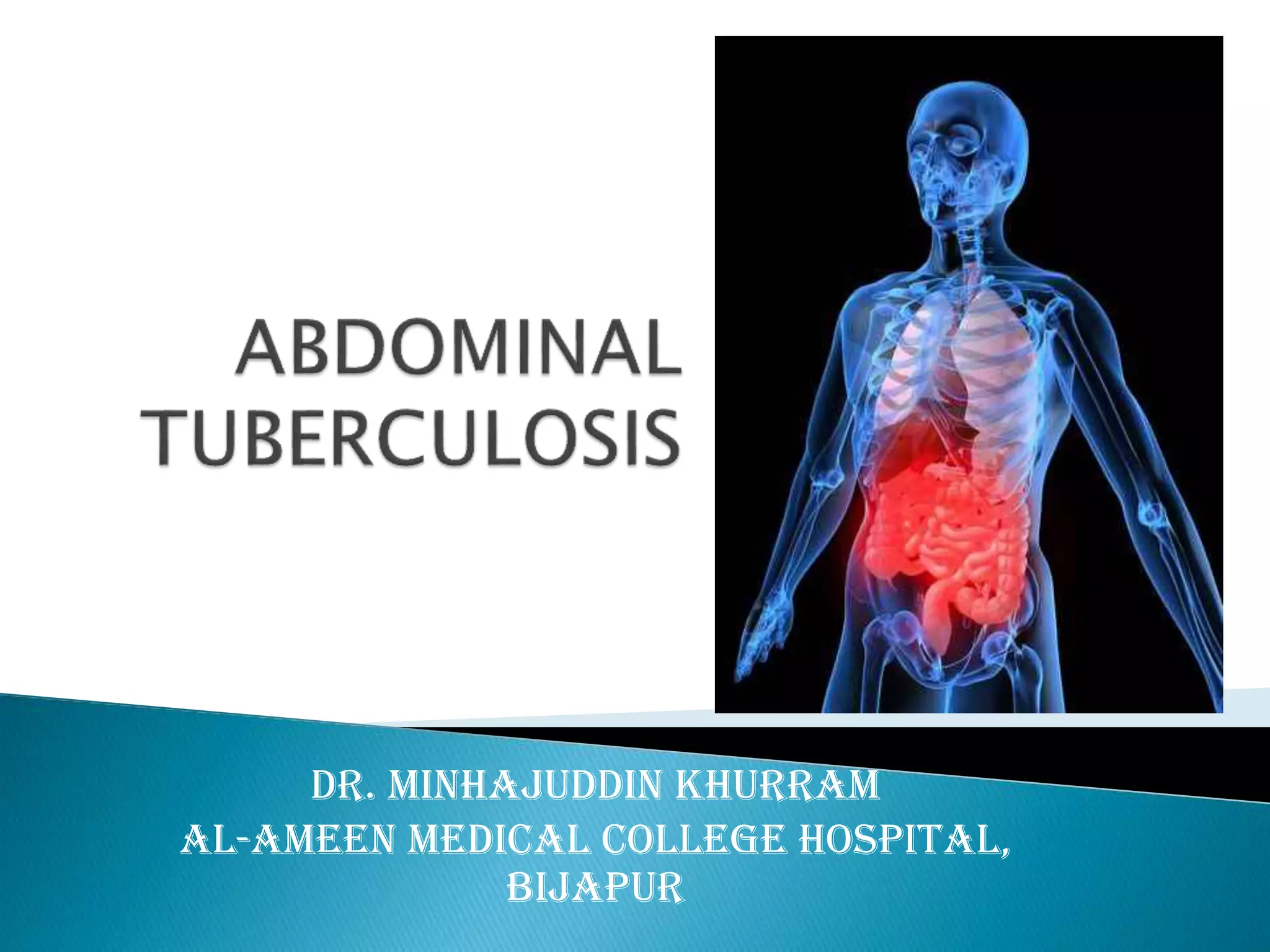 Abdominal tuberculosis | PPTX