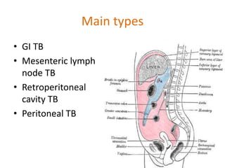 Abdominal Tuberculosis | PPTX