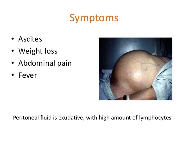 Abdominal Tuberculosis