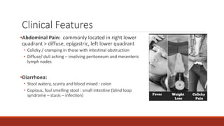 Abdominal Tuberculosis.pptx