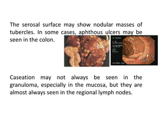 Abdominal tuberculosis gen. med | PPT