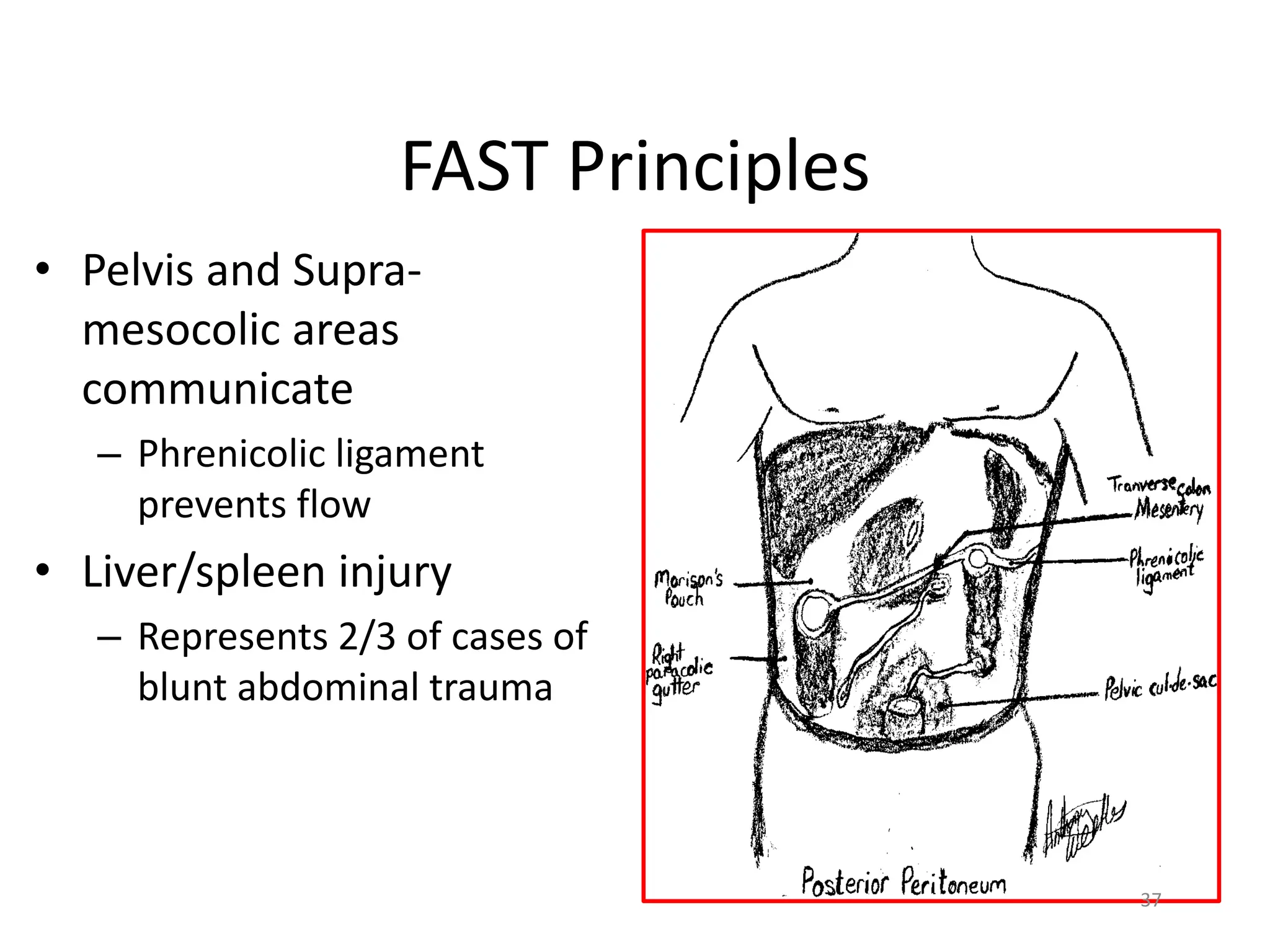 Abdominal ultrasound for midwifery students .pptx