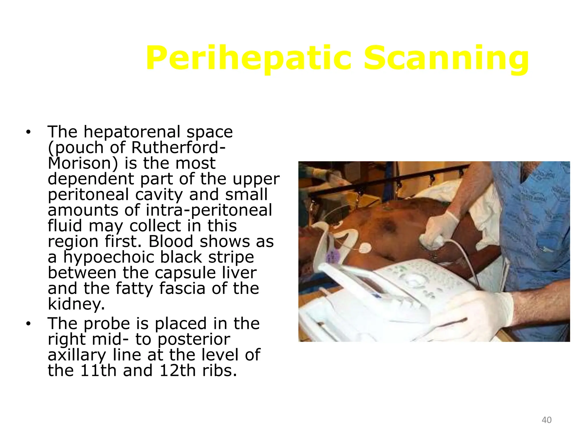 Abdominal ultrasound for midwifery students .pptx
