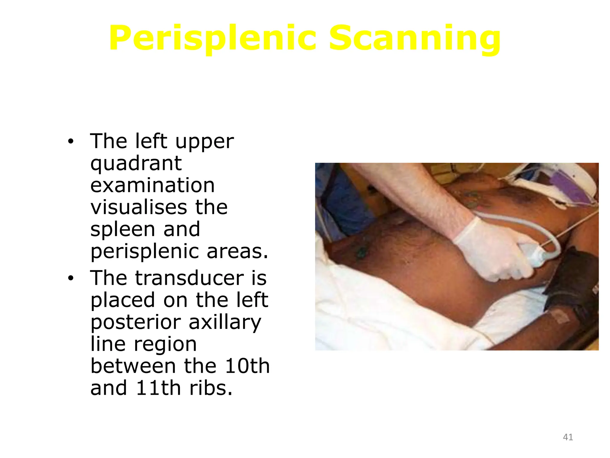 Abdominal ultrasound for midwifery students .pptx