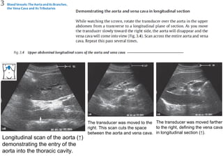 Blood vessels the aorta and its branches, | PPT