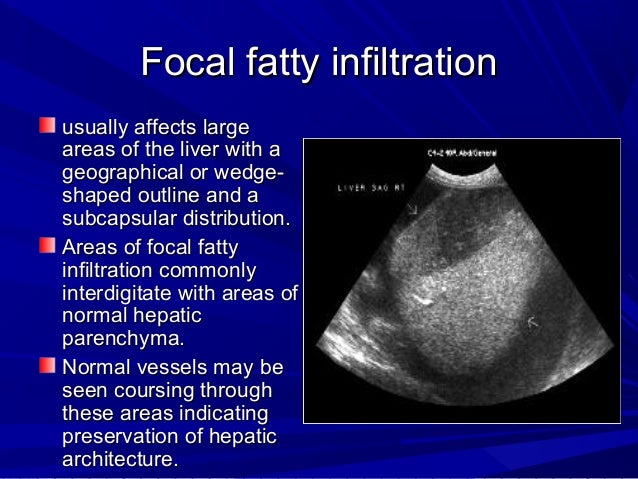 Abdominal us & its different applications